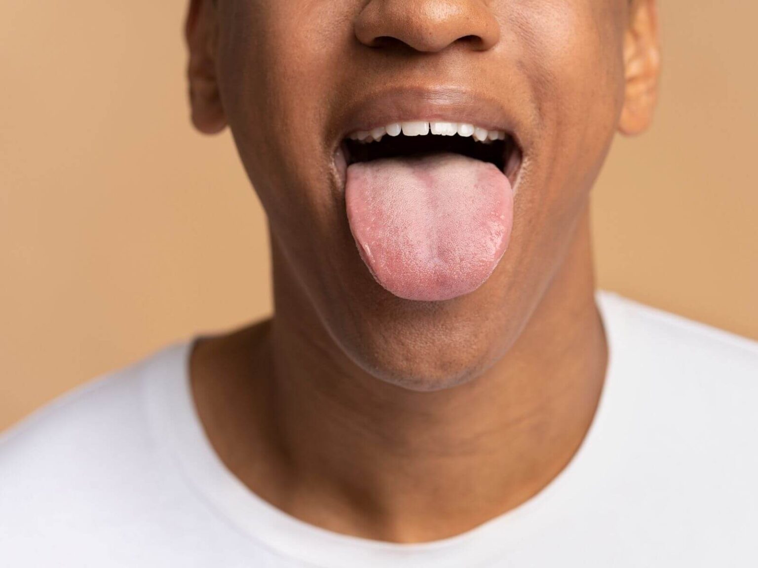 Understanding Lip Ties & Tongue Ties with Liberty Dentist TX